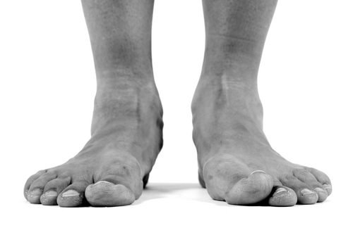 Athlete's Foot | G4 Physio